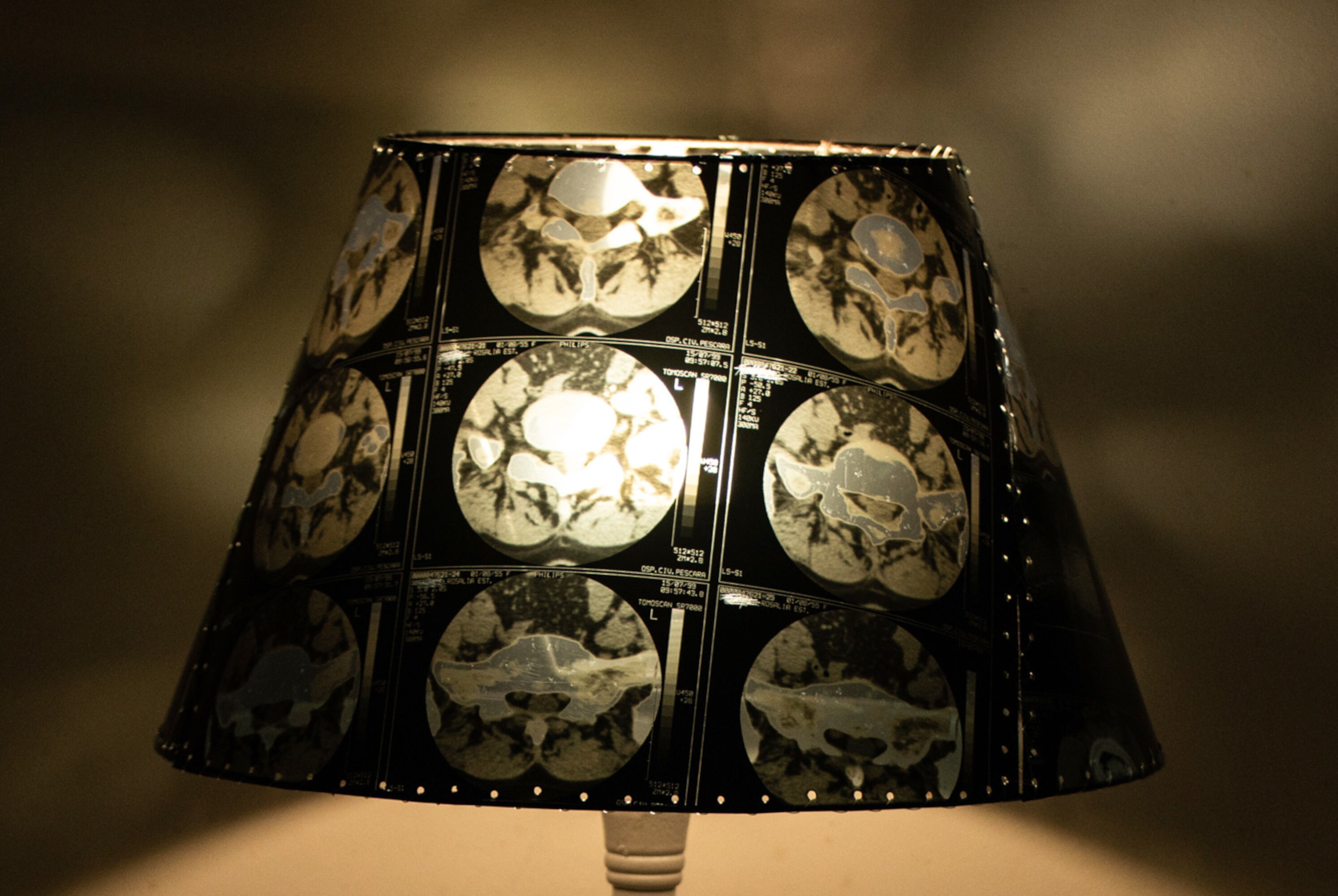 Table Lamp X Ray Rmi Tc Spine Radiography Doctor Etsy