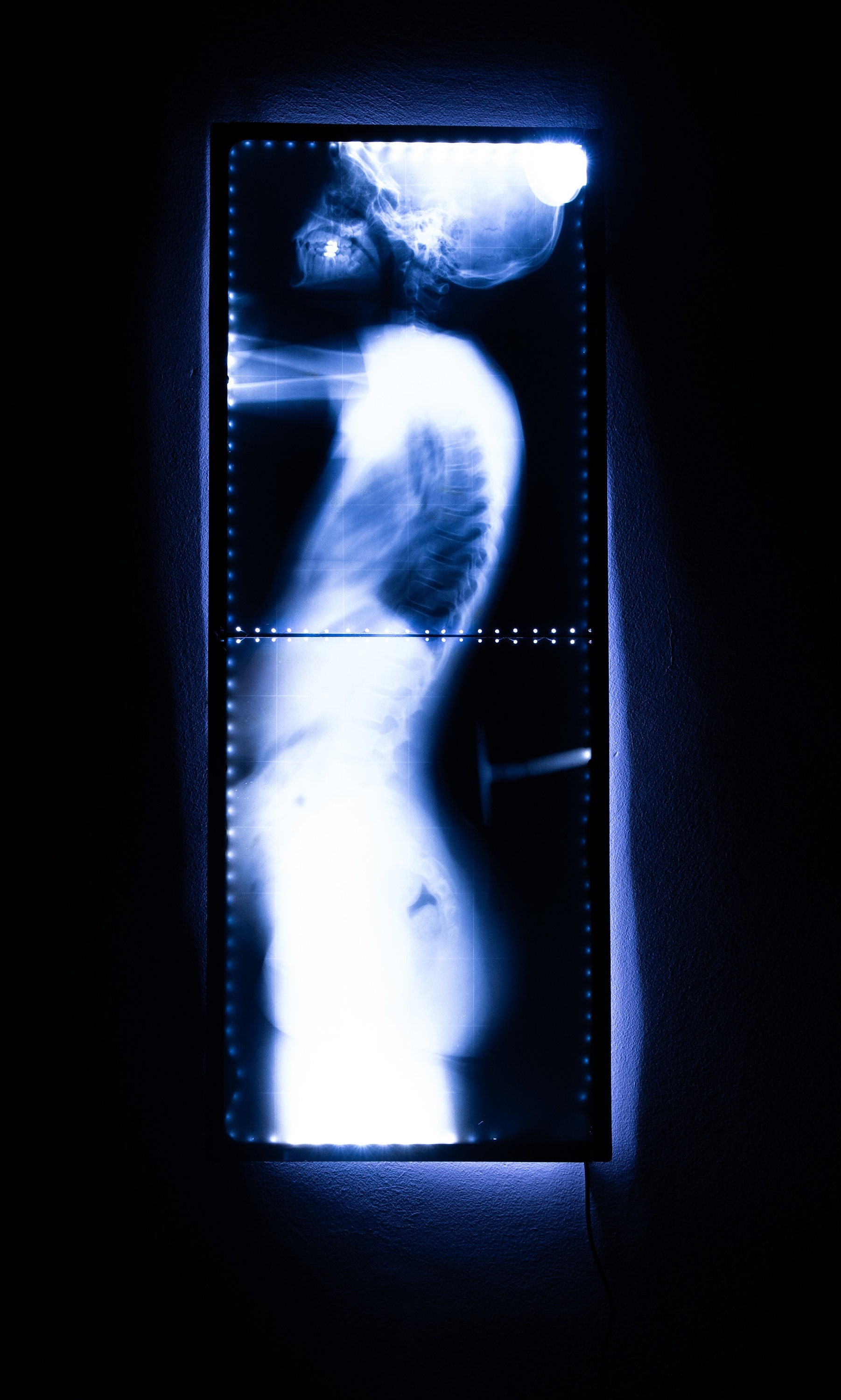 X-ray Led Lighted Picture Total Body, Spooky X-ray Pics for Goth Homes ...