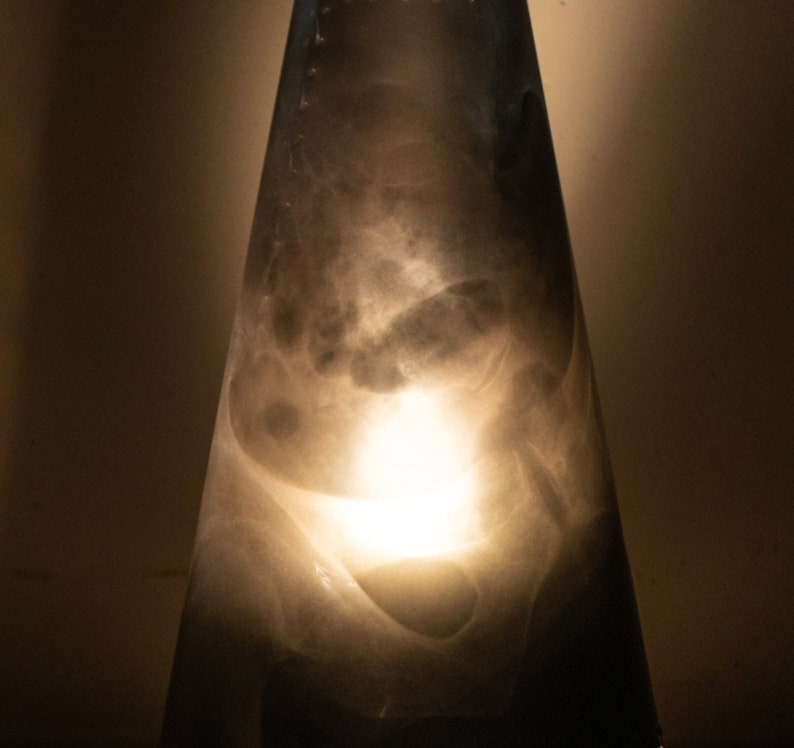 Table Lamp With Hip Prosthesis X-ray Film Doctor Radiologist - Etsy