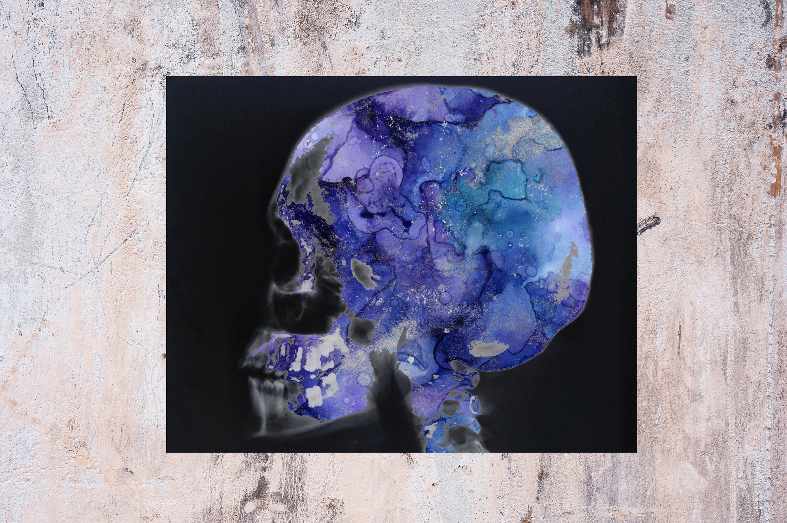 Instant Digital Download Printable Photo, X-ray Skull , Hands and Legs ...