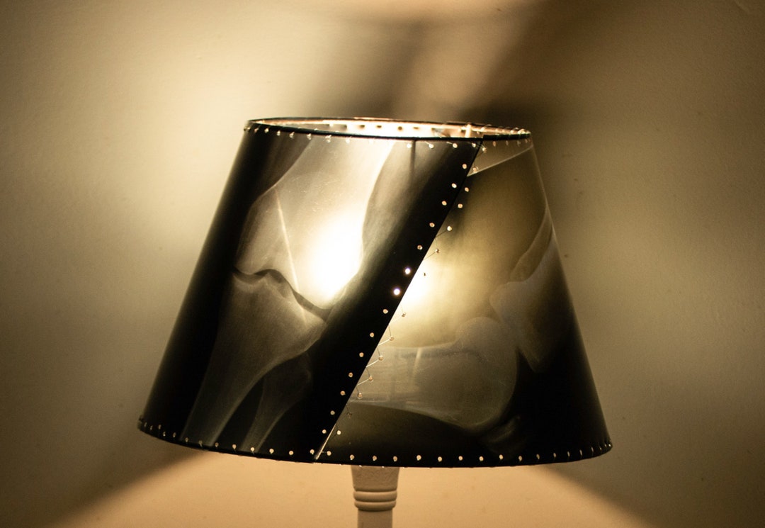 Table Lamp X Ray Knees Radiography Doctor Radiologist T Interior