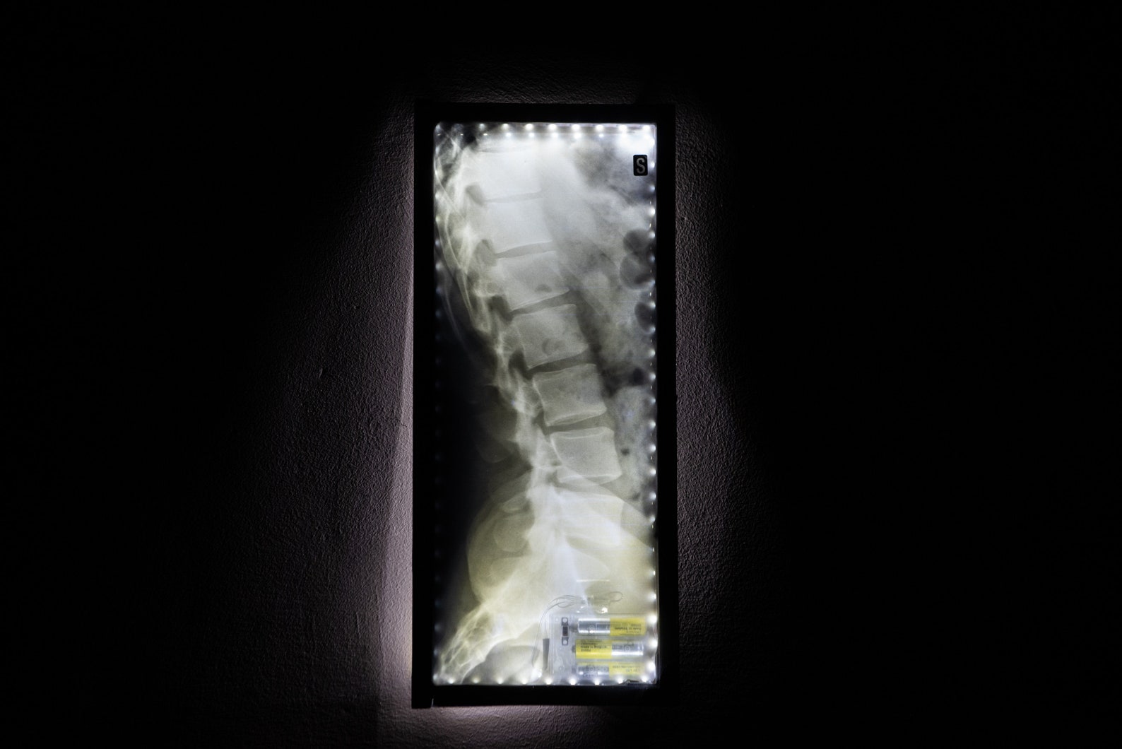 X-ray Led Lighted Picture With Spine, Brighted Radiography Picture ...