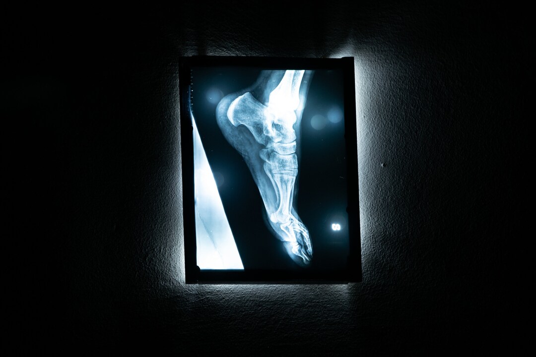 X-ray Led Lighted Picture With Foot, Skeleton Brighted Sign, Anatomical ...
