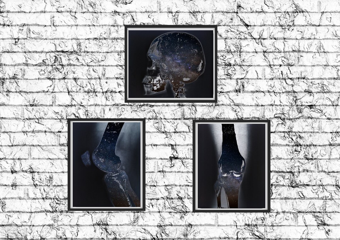 Instant Digital Download Printable Cosmos Photo in X-ray Skull and Legs ...