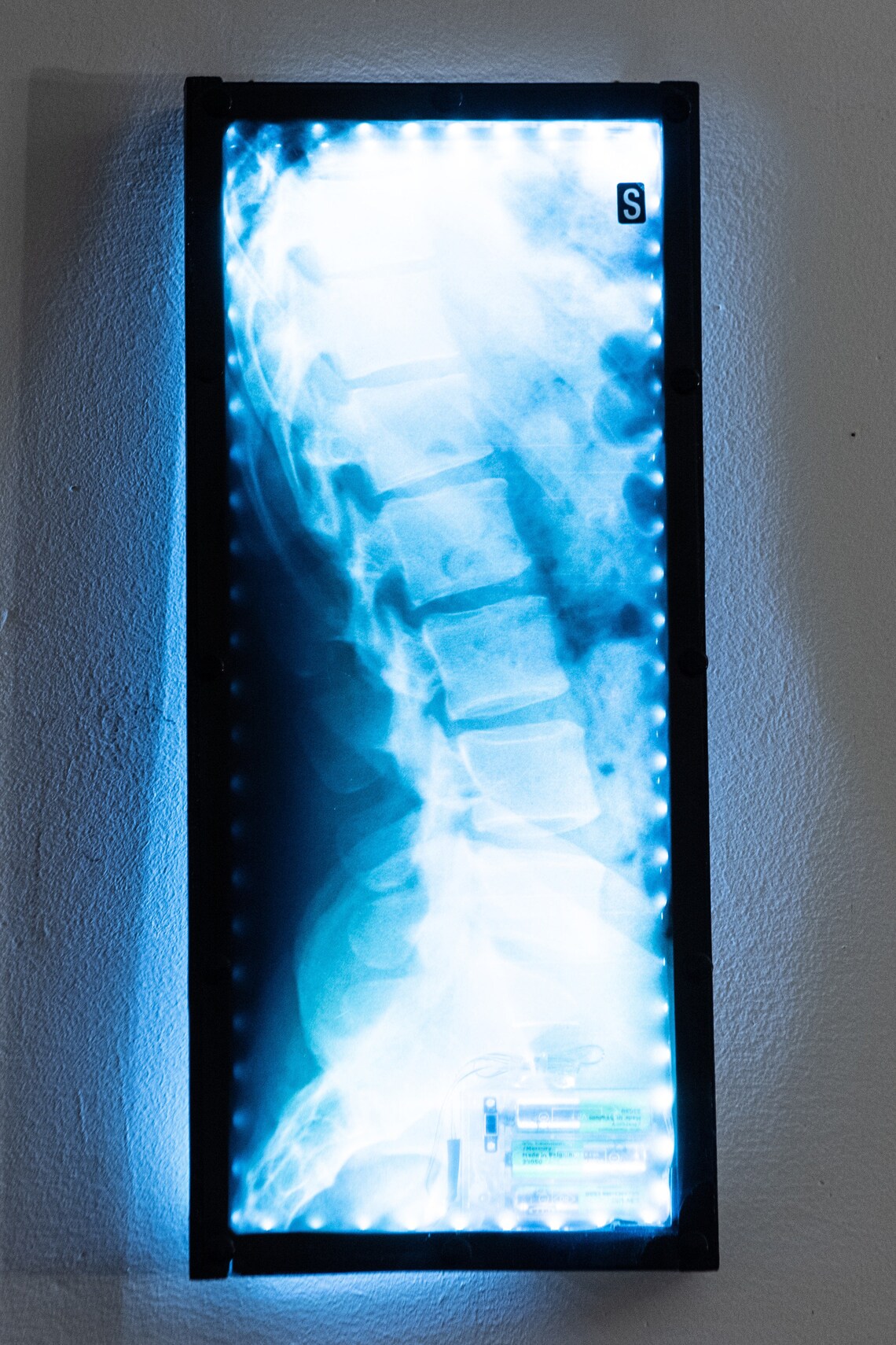 X-ray Led Lighted Picture With Spine, Brighted Radiography Picture ...