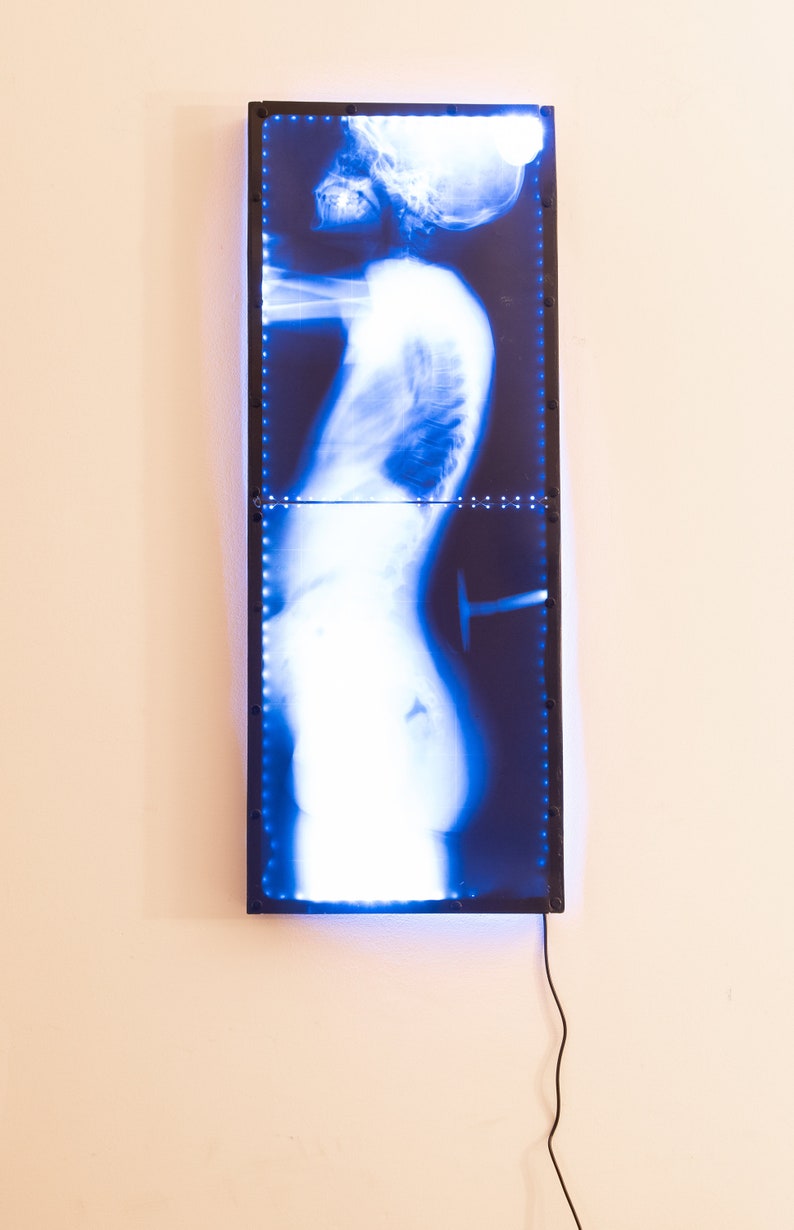 X-ray Led Lighted Picture Total Body, Spooky X-ray Pics for Goth Homes ...