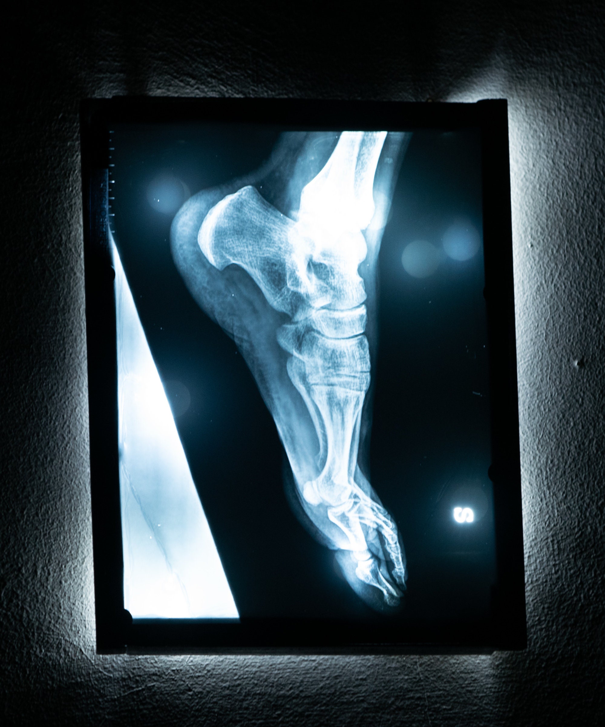 X-ray Led Lighted Picture With Foot, Skeleton Brighted Sign, Anatomical ...