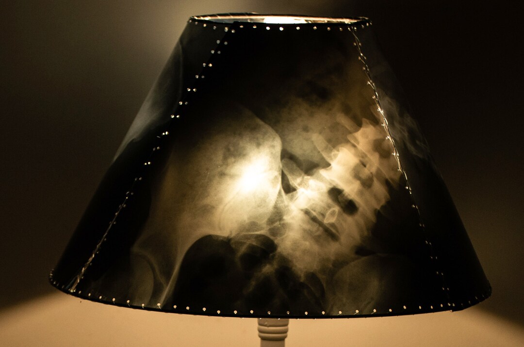 Table Lamp X-ray Spine Radiography Doctor Radiographer Gift - Etsy