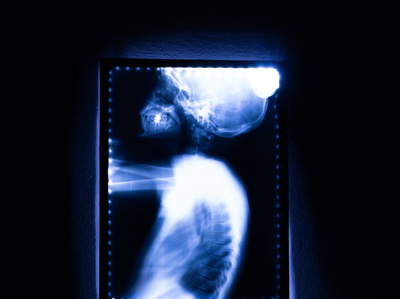 X-ray Led Lighted Picture Total Body, Spooky X-ray Pics for Goth Homes ...