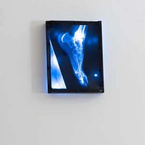X-ray Led Lighted Picture With Foot, Skeleton Brighted Sign, Anatomical ...