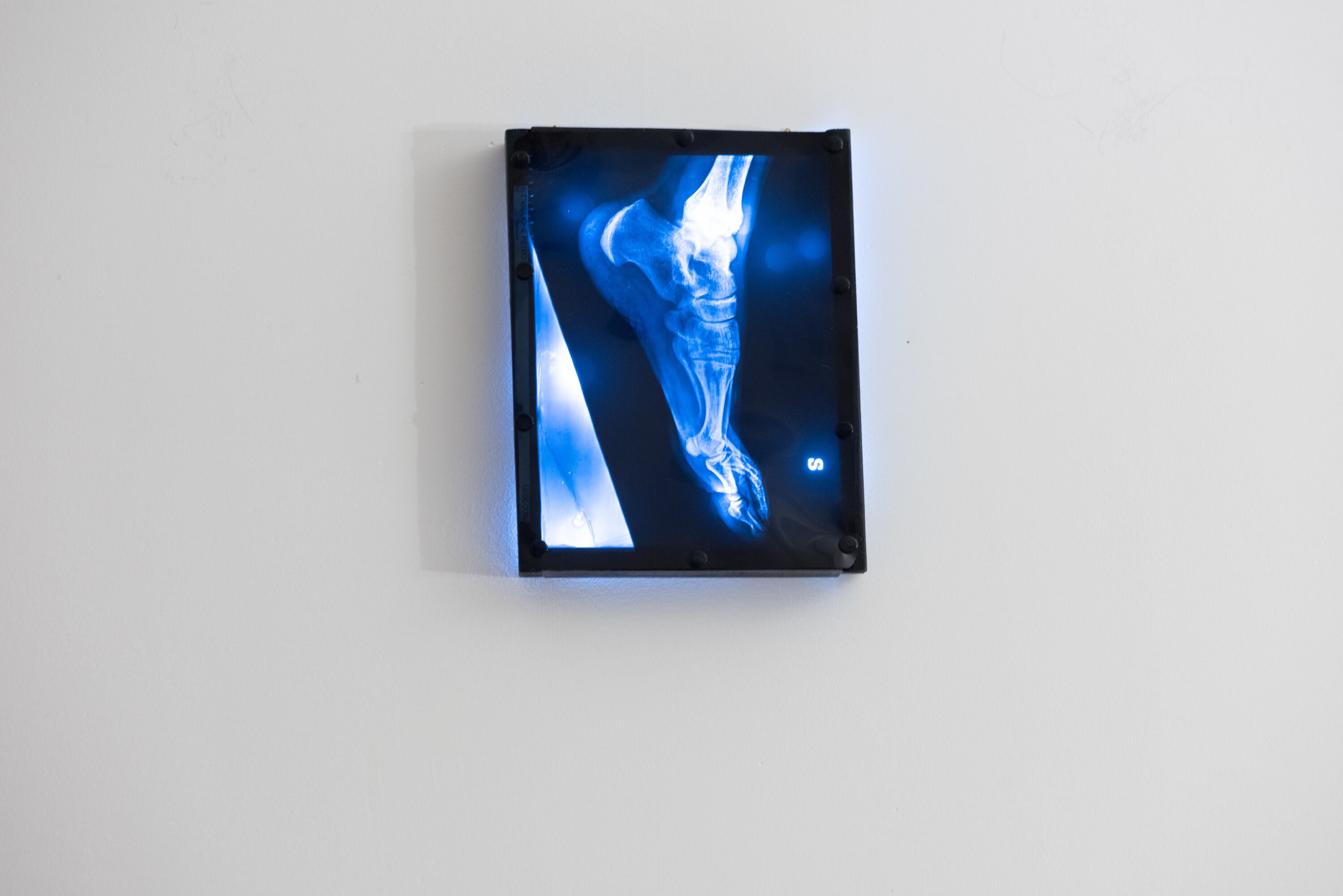 X-ray Led Lighted Picture With Foot, Skeleton Brighted Sign, Anatomical ...