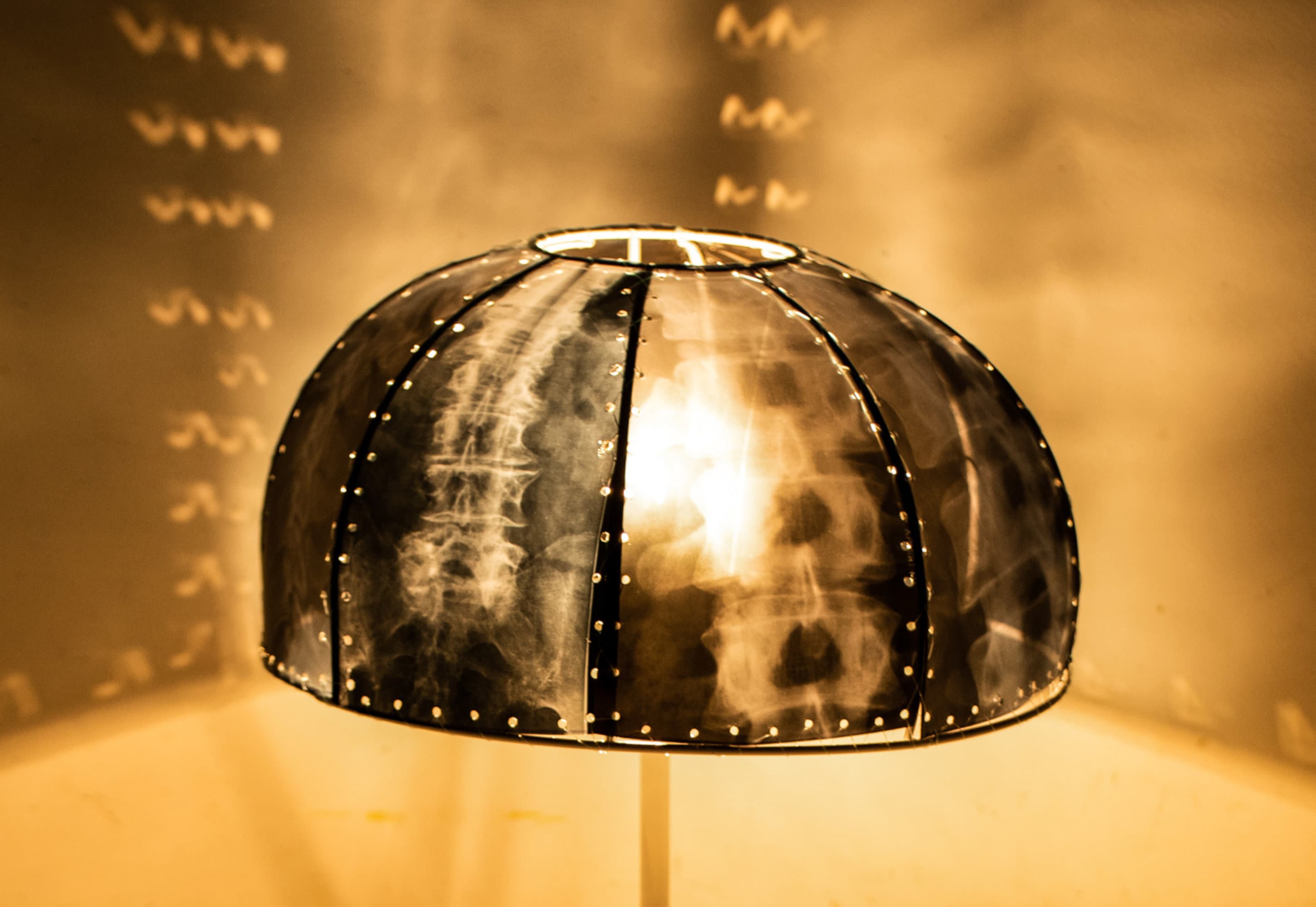 Table Lamp With Spinal Column X-ray, Images for a Medical Art Lampshade ...