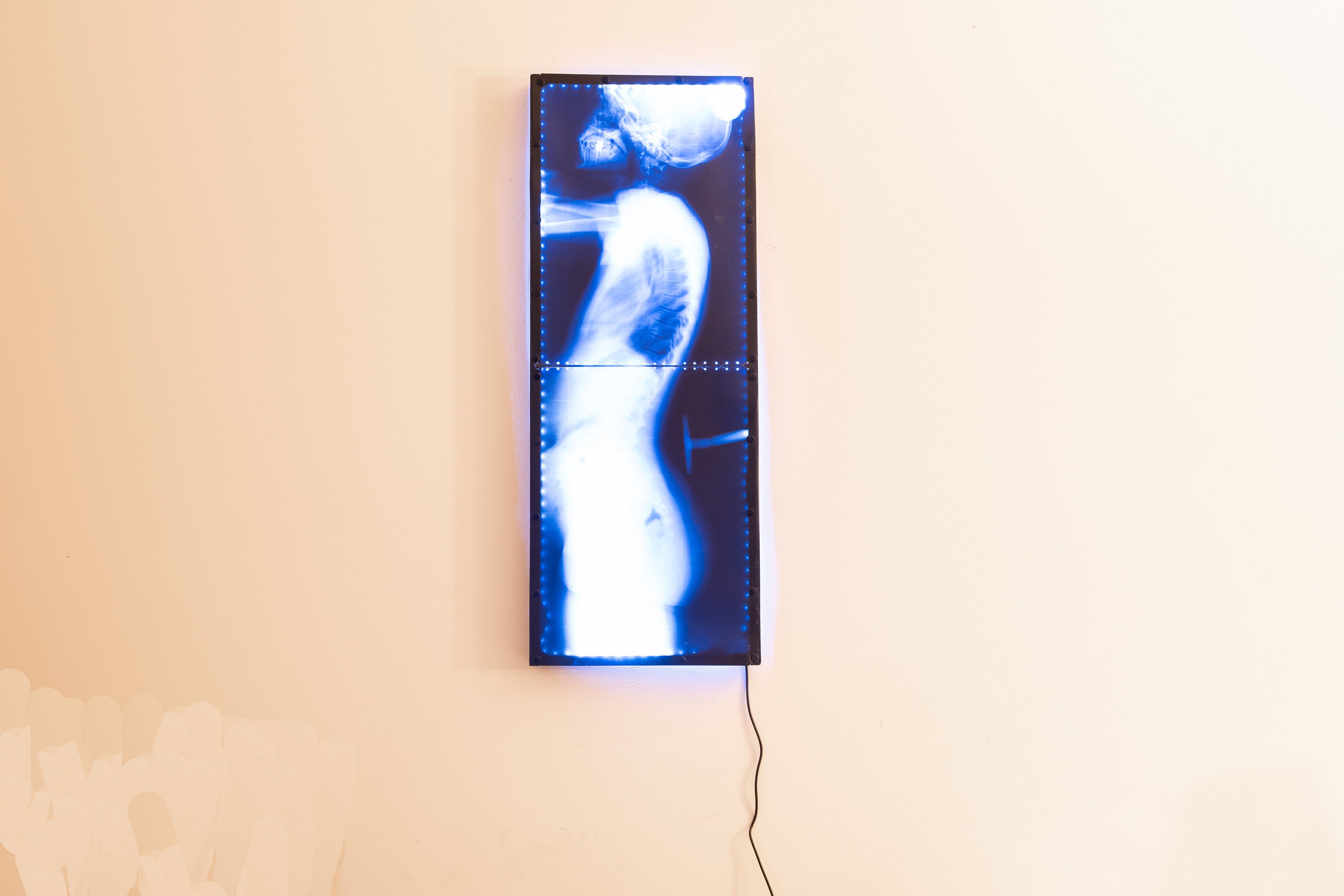 X-ray Led Lighted Picture Total Body, Spooky X-ray Pics for Goth Homes ...