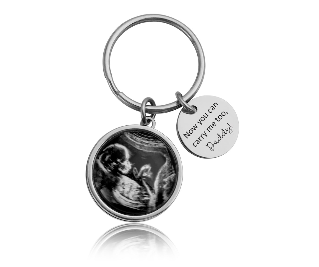 Personalized Baby Ultrasound Keychain, Baby Scan Sonogram Picture Photo ...