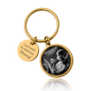 Personalized Ultrasound Keychain, Baby Scan Sonogram Picture Photo ...