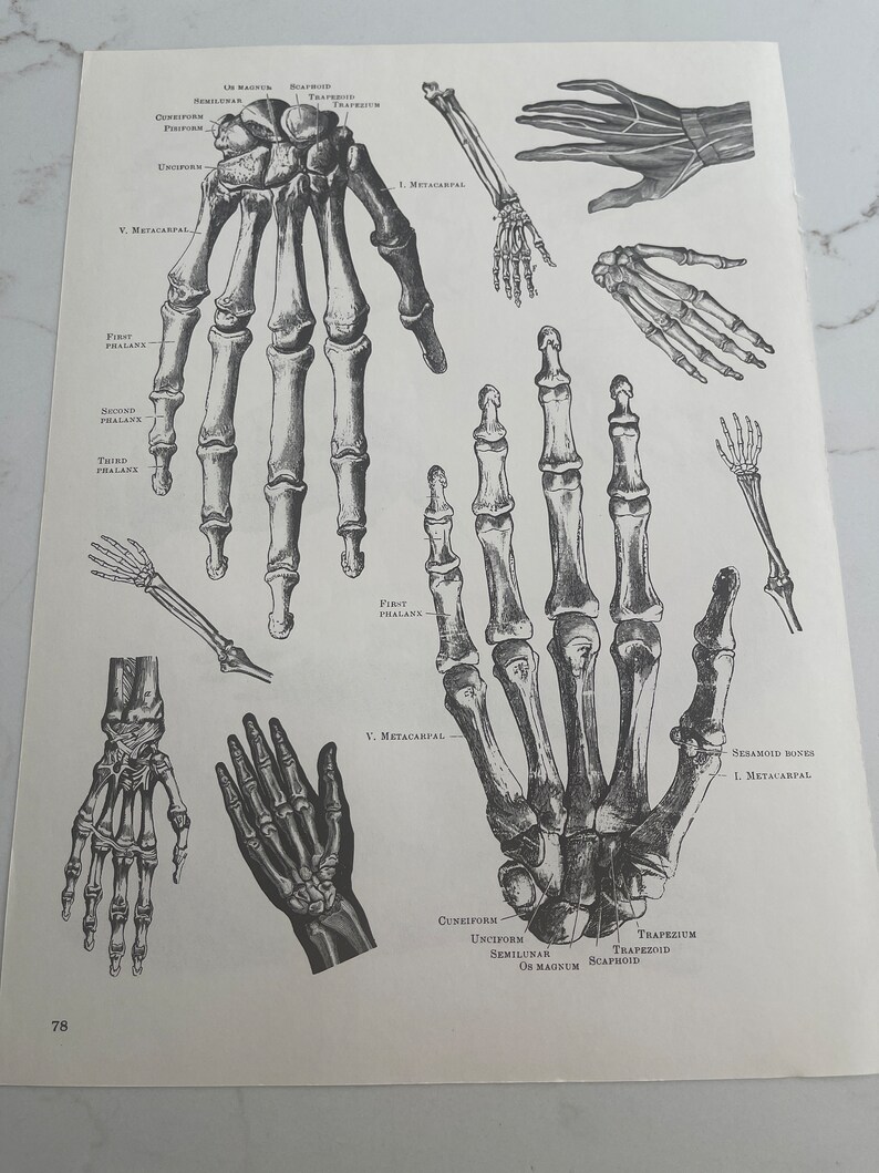 Hands Anatomy Bones Skeleton Palm Poster Bookplate - Etsy