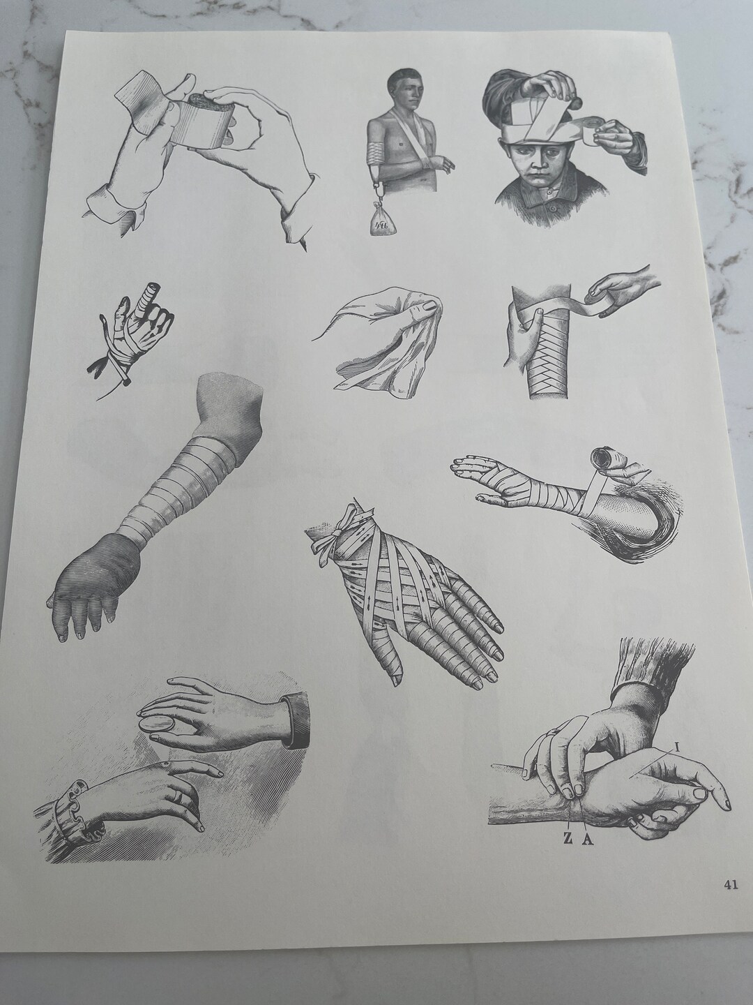 Hands, Prosthesis, Bandage, X-ray, Pulse, Medicine, Print, Poster ...