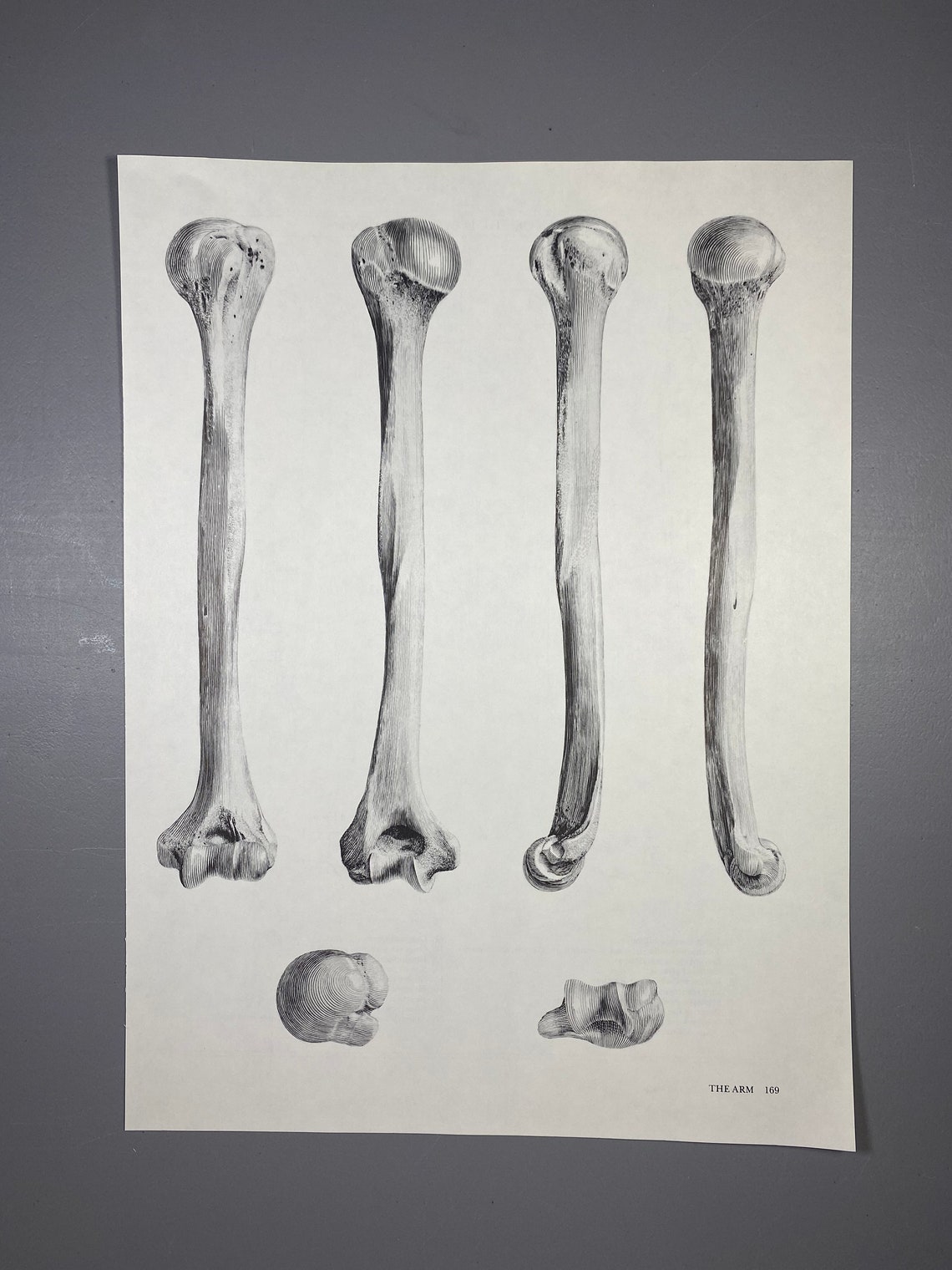 Albinus on Anatomy, Upper Arm Bones, Humerus and Ulna, Print, Book Page ...