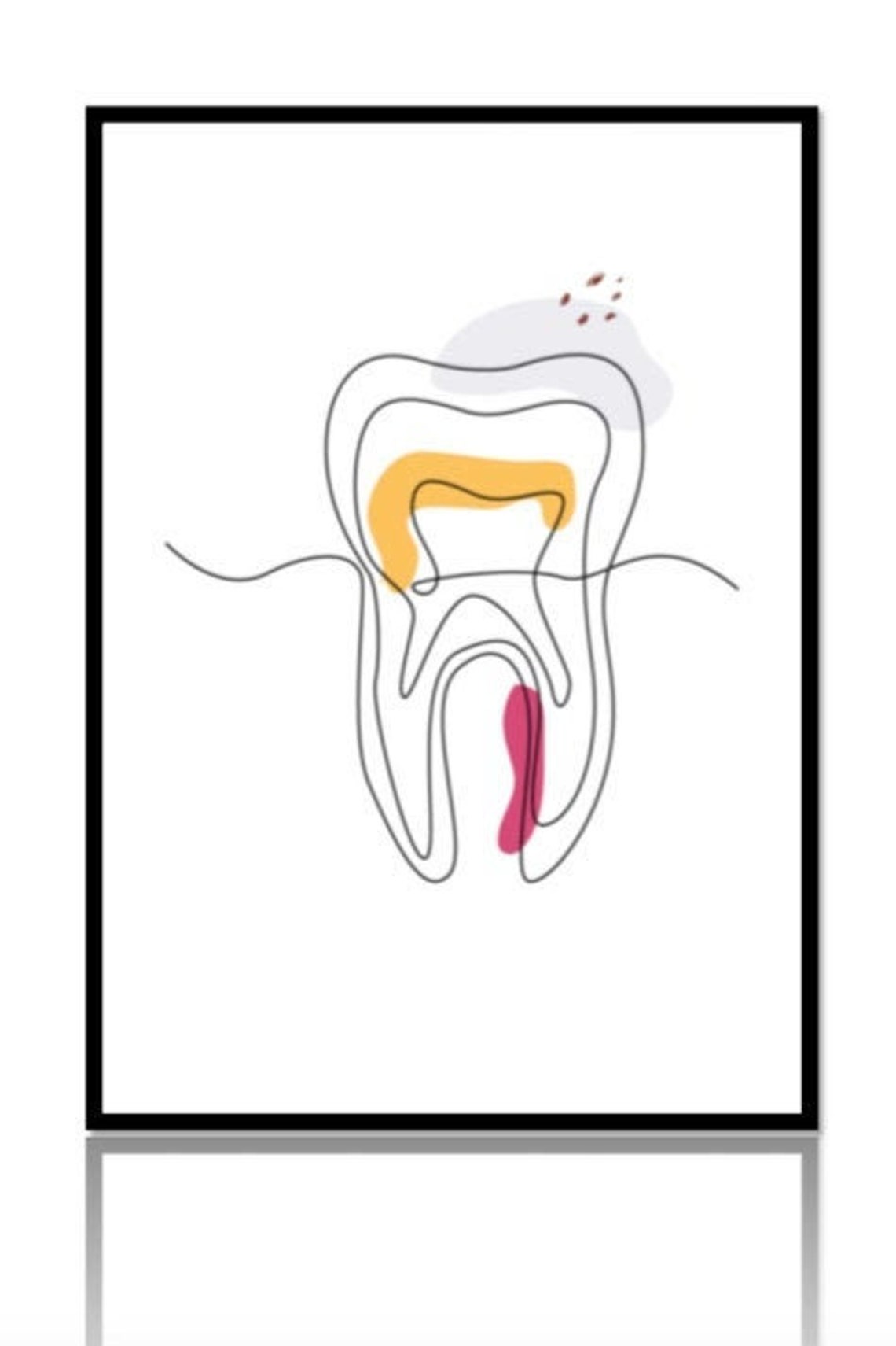 Tooth Line Art Modern Minimal Wall Art Anatomy Art | Etsy