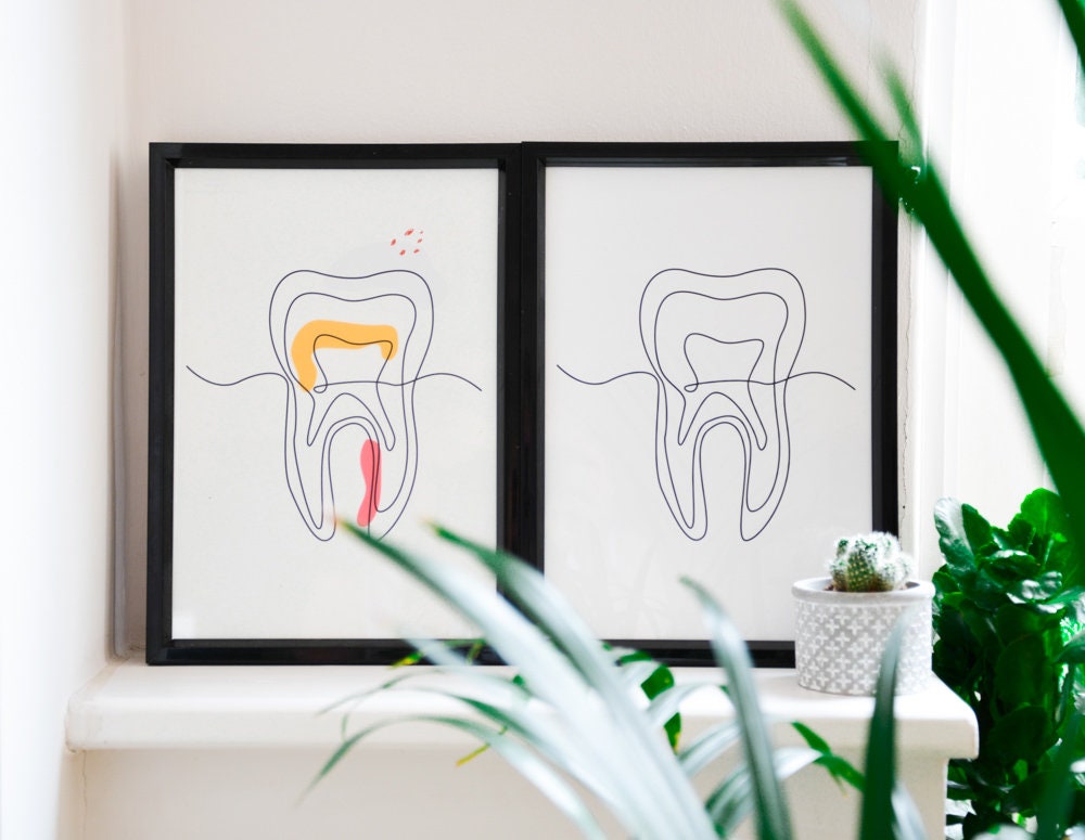 Tooth Line Art, Modern Minimal, Wall Art, Anatomy Art, PRINTABLE ...
