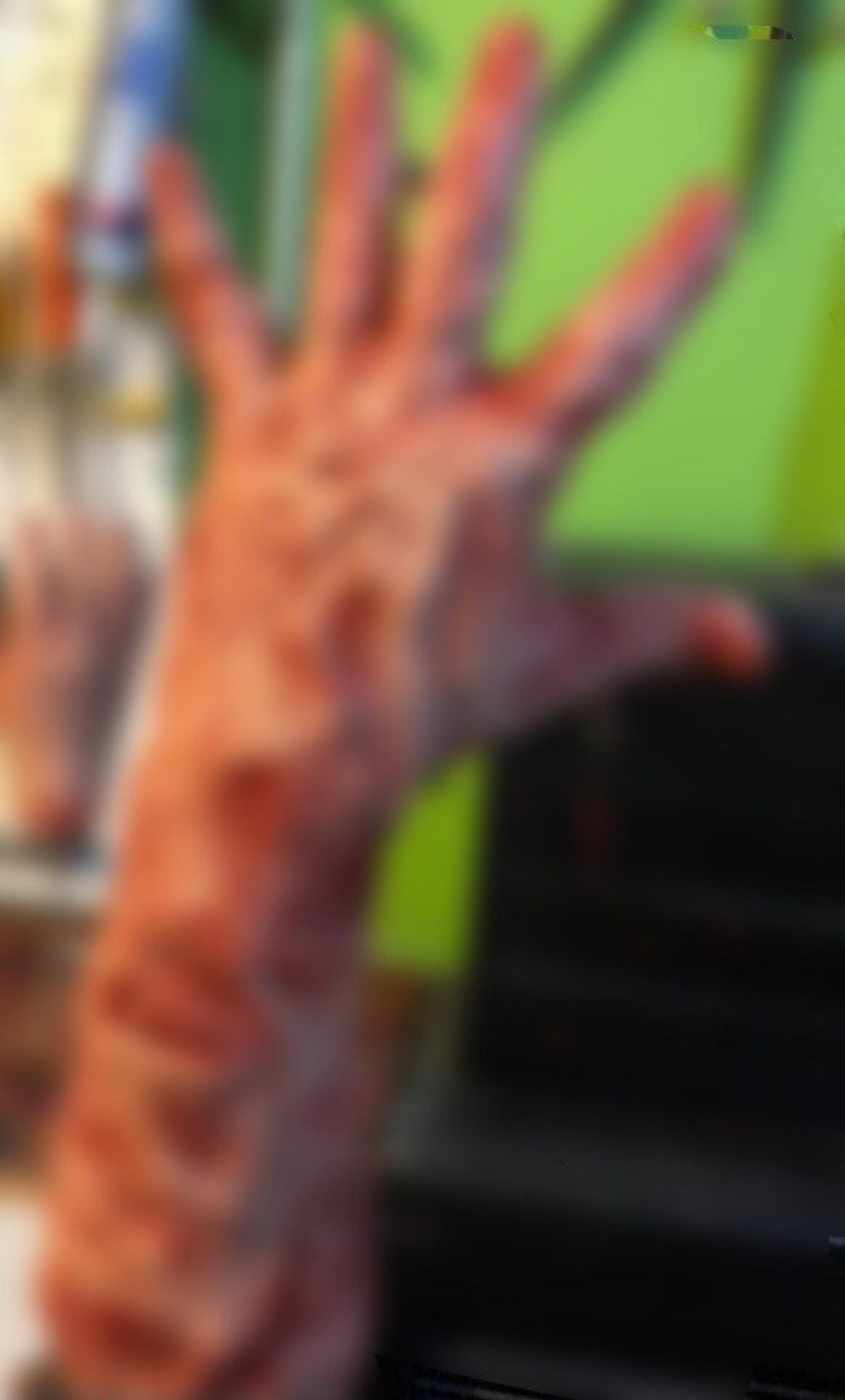 Burned Victim Arm - Etsy Canada