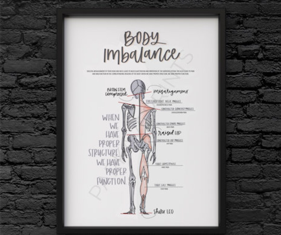Body Imbalance Chiropractic Anatomy Poster - Etsy