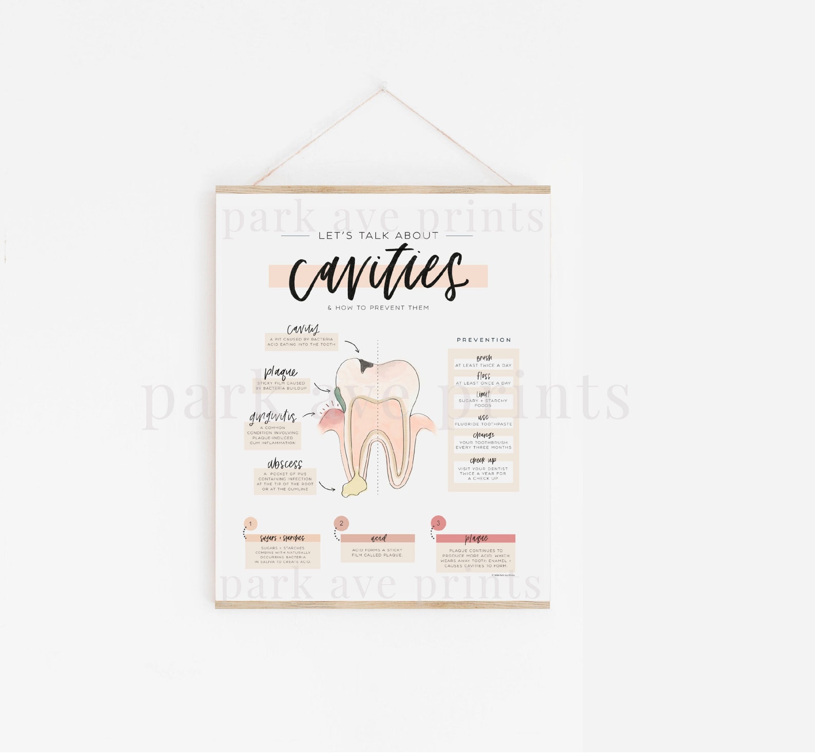 Cavity Prevention Poster | Dentist Poster | Dental Hygienist *frame Not ...