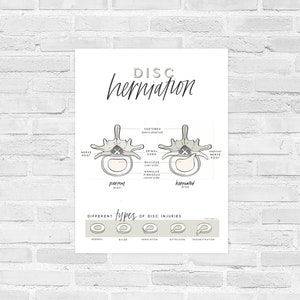 New! Disc Herniation Poster Chiropractic Spine Health - Etsy