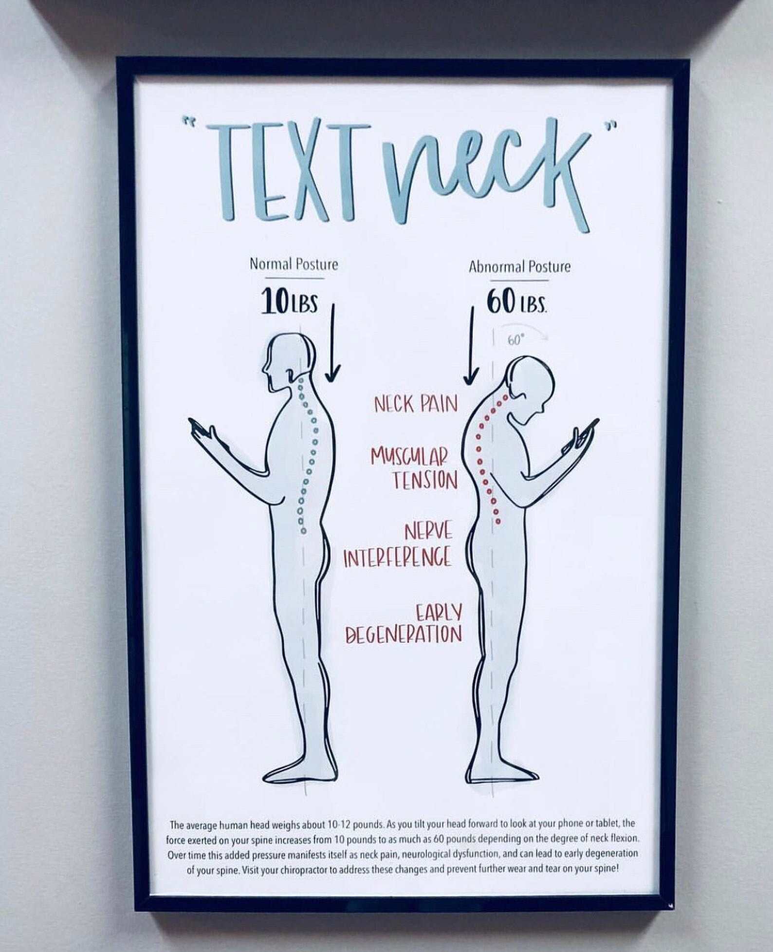 Text Neck Chiropractic Poster Subluxation Symptoms Spine | Etsy Text Neck Chiropractic Poster Subluxation Symptoms Spine | Etsy