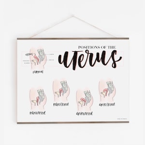 NEW Positions of the Uterus Poster Female Anatomy | Etsy
