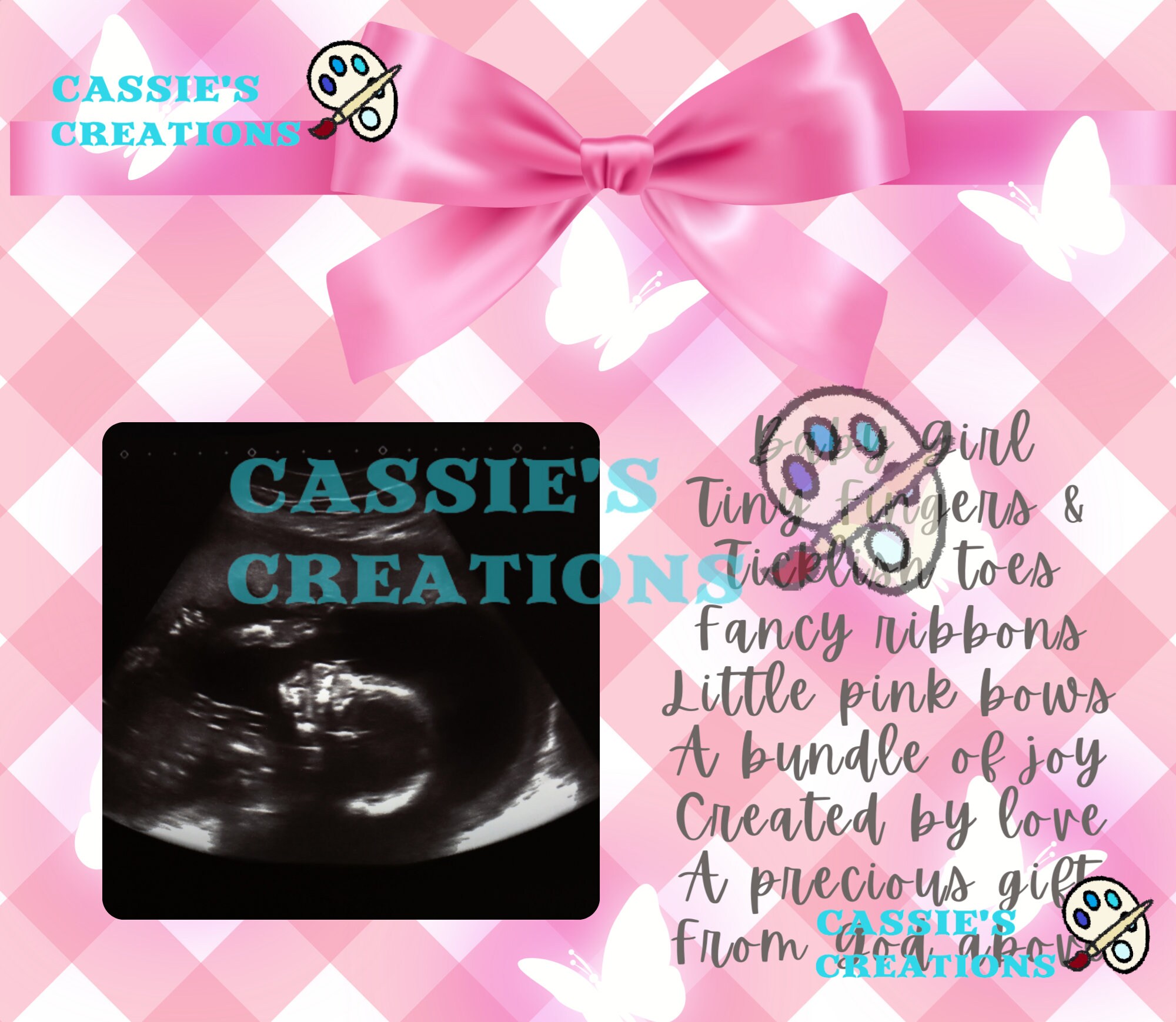 Baby Boy Baby Girl Ultrasound Newborn Infant Tumbler Design Sonogram ...