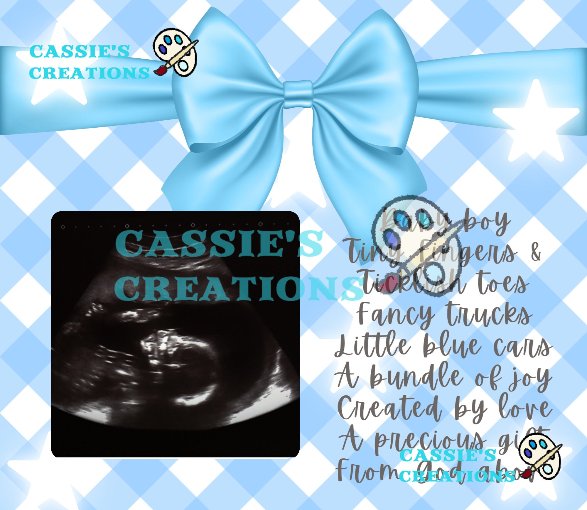 Baby Boy Baby Girl Ultrasound Newborn Infant Tumbler Design Sonogram ...