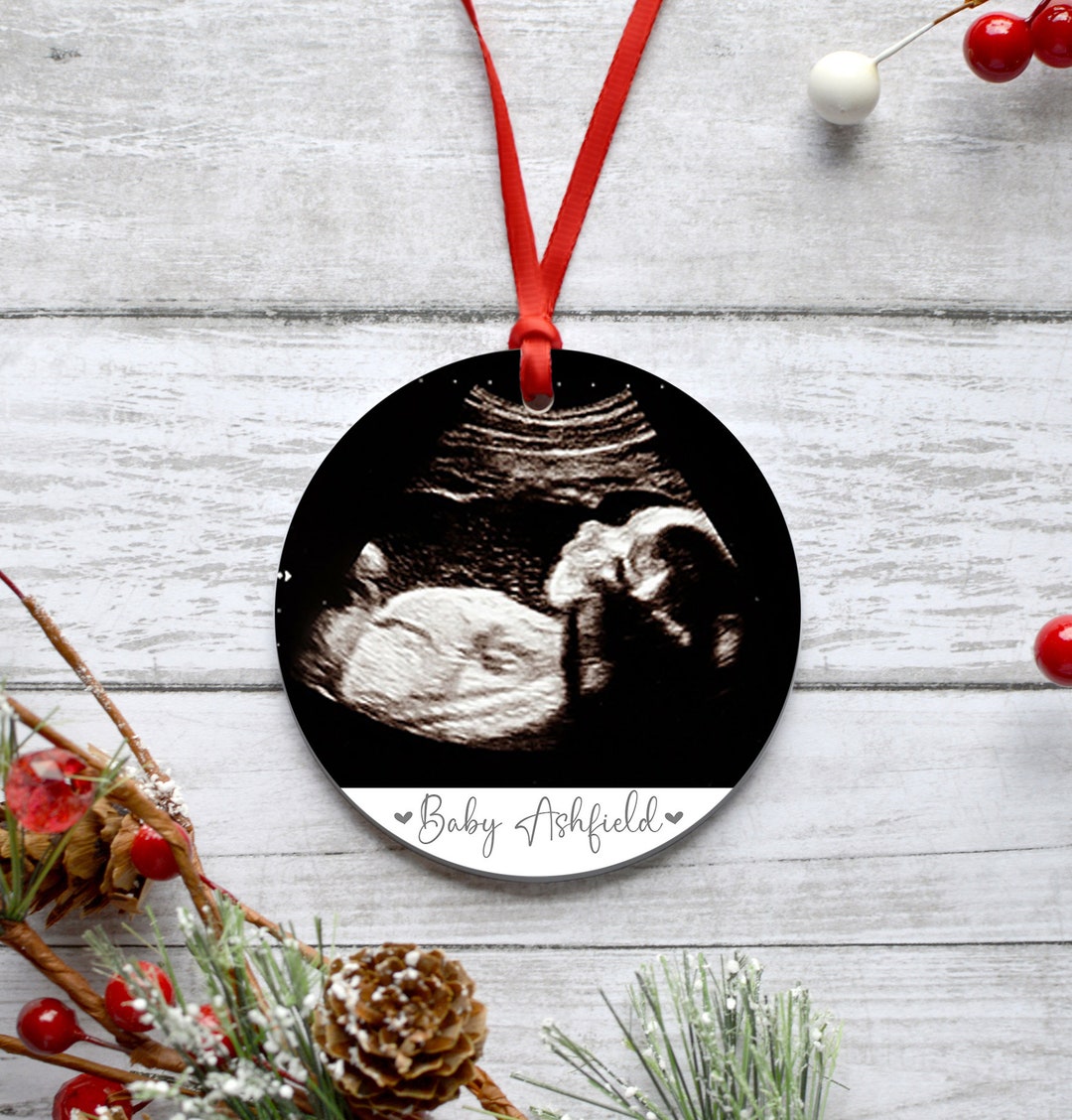 Personalised Photo Bauble Tree Decoration Christmas Baby Scan Name ...