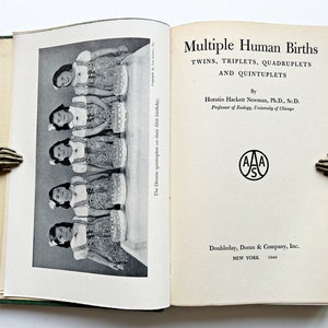 Multiple Human Births Conjoined Twins Triplets Quadruplets - Etsy