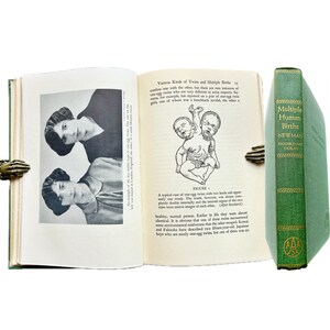 Multiple Human Births Conjoined Twins Triplets Quadruplets - Etsy