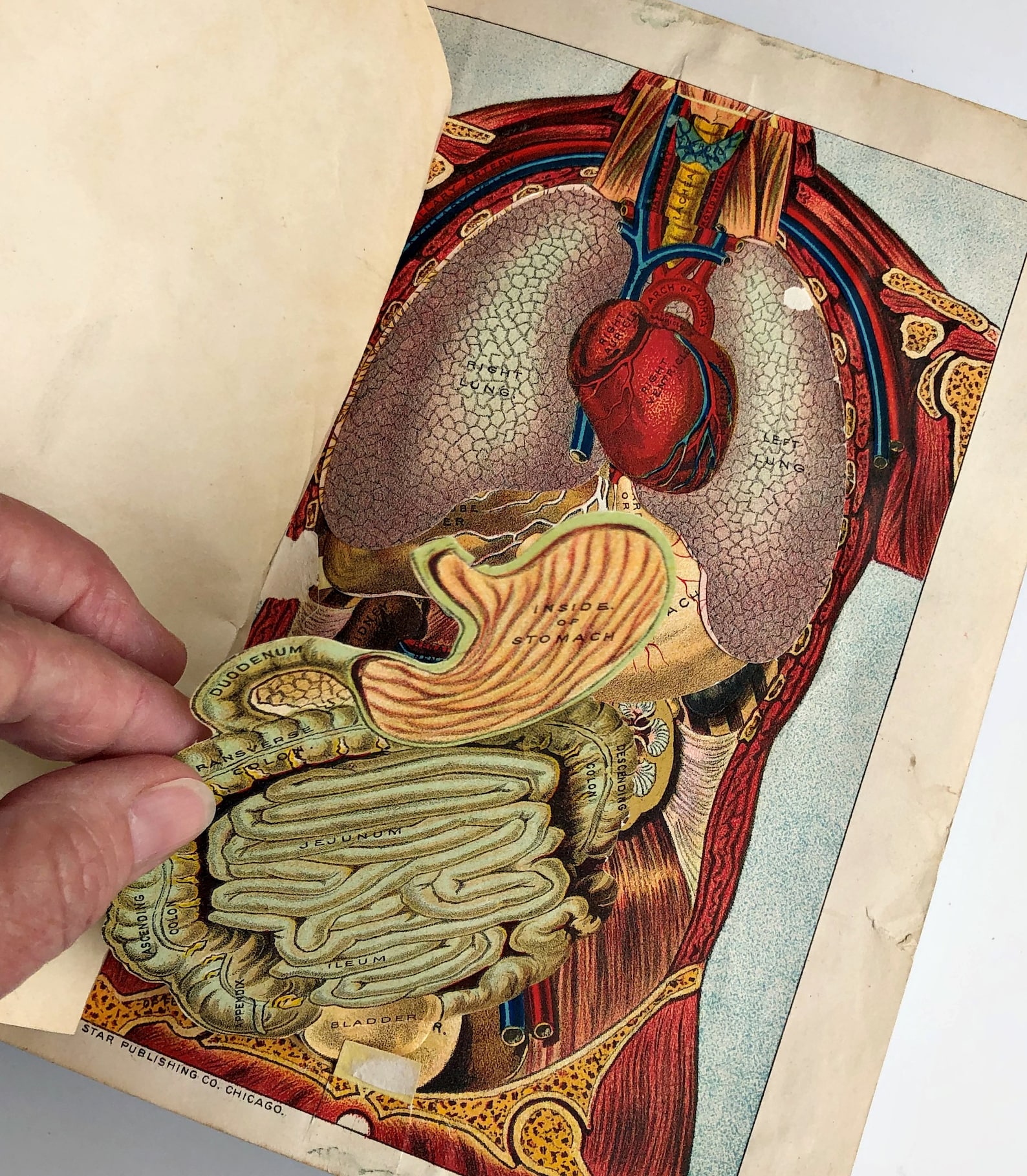 Antique Medical Book 1916 Practical Home Physician Illustrated Etsy antique-medical-book-1916-practical-home-physician-illustrated-etsy