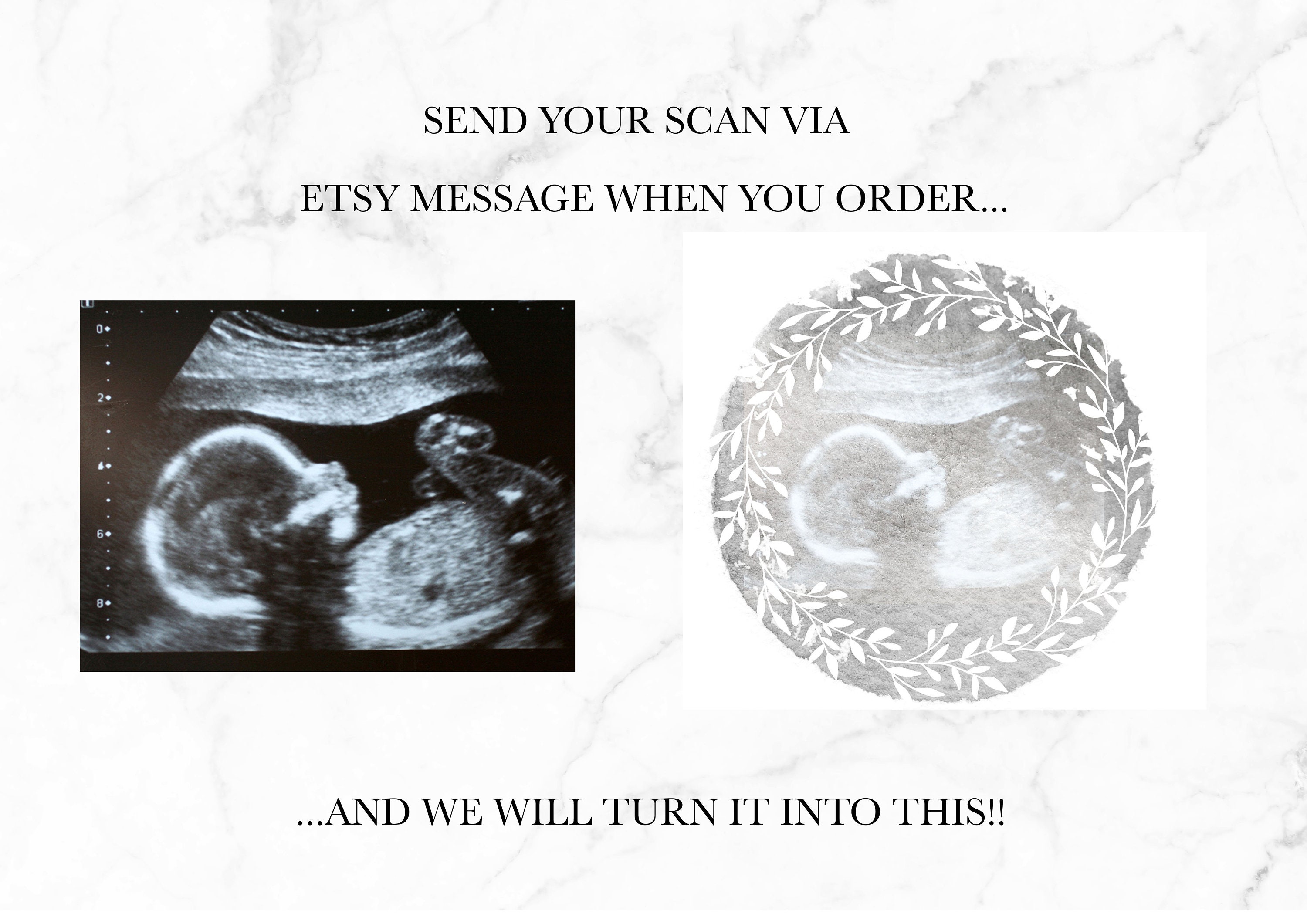 Baby Scan Ultrasounds Sonogram Print Unframed A4 - Etsy