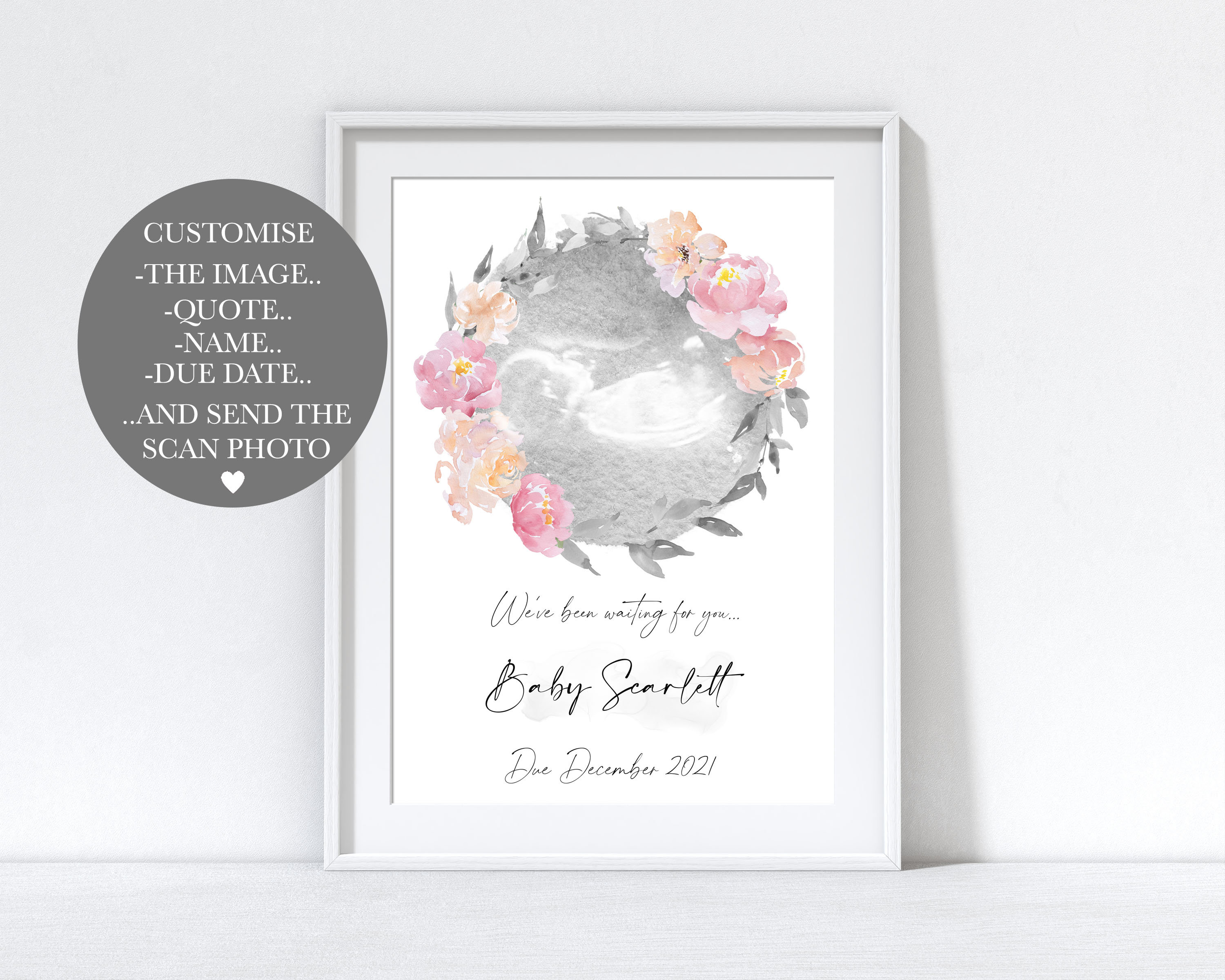 Baby Scan Ultrasounds Sonogram Print Unframed A4 - Etsy