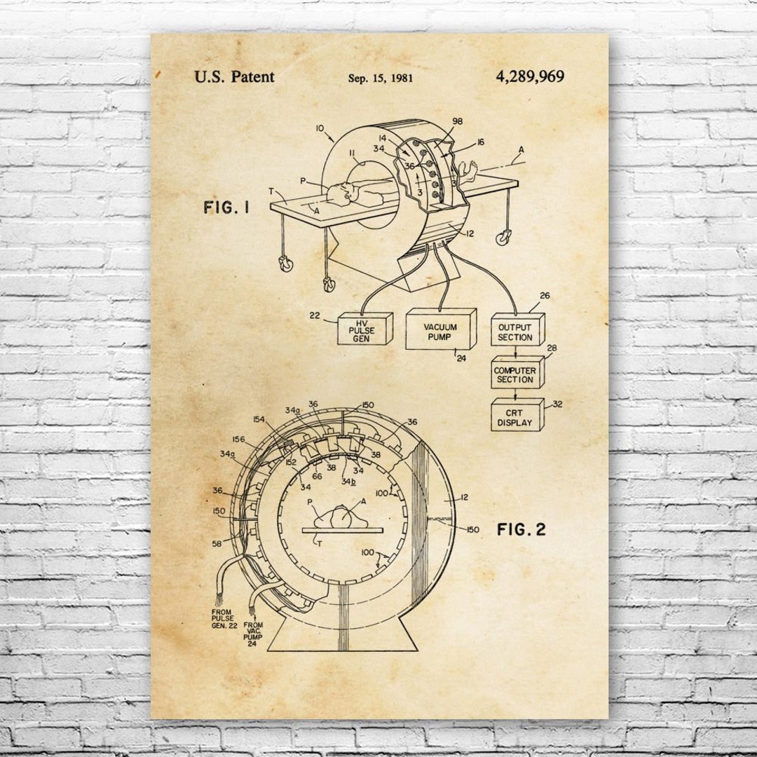 CAT Scan Poster Print, Doctors Office, Lab Technician, Oncologist Gift ...