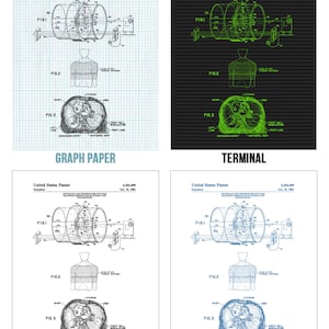 MRI Machine Patent Prints Set of 2 MRI Blueprint Surgeon - Etsy