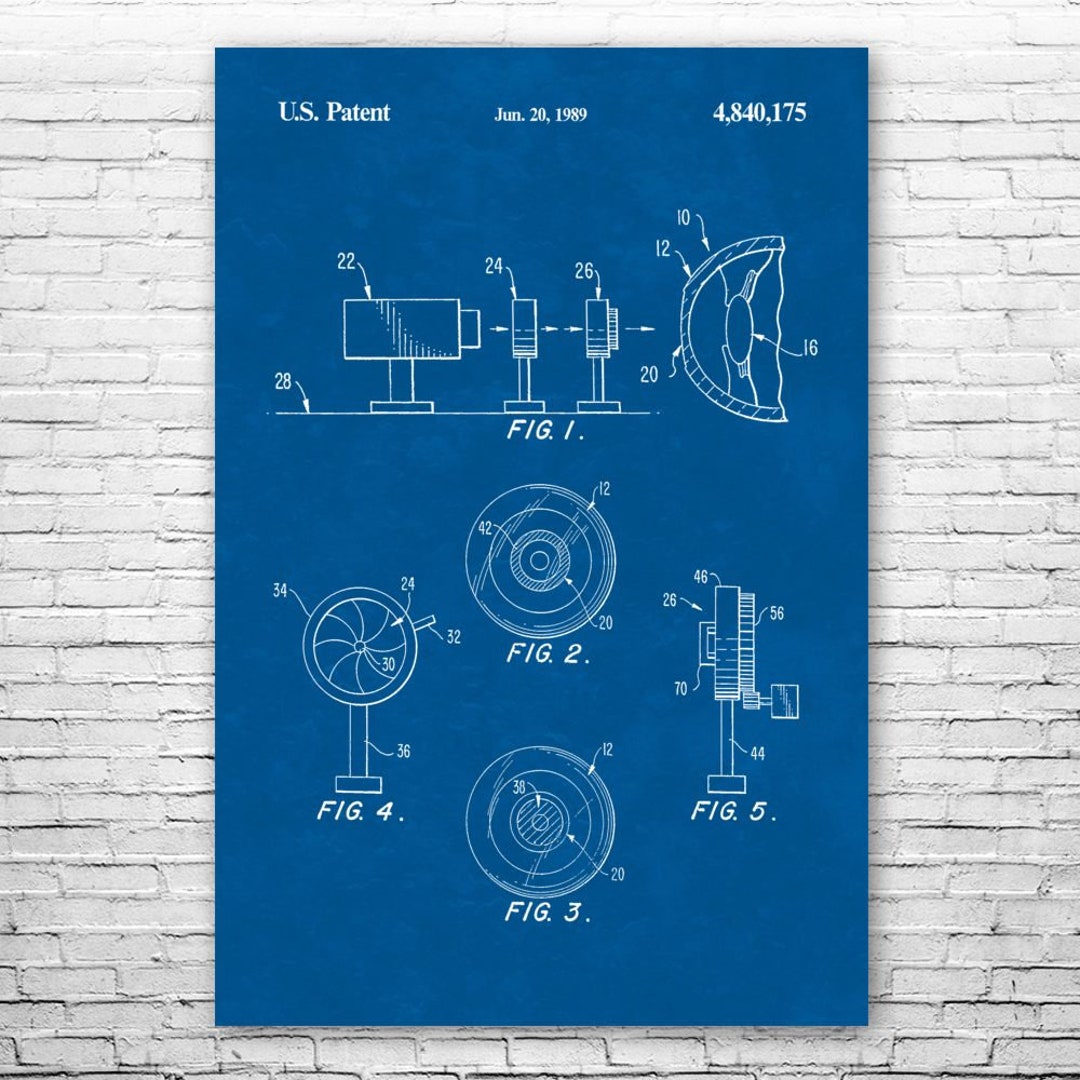 LASIK Procedure Poster Print, Eye Doctor Gift, Eye Clinic Decor ...