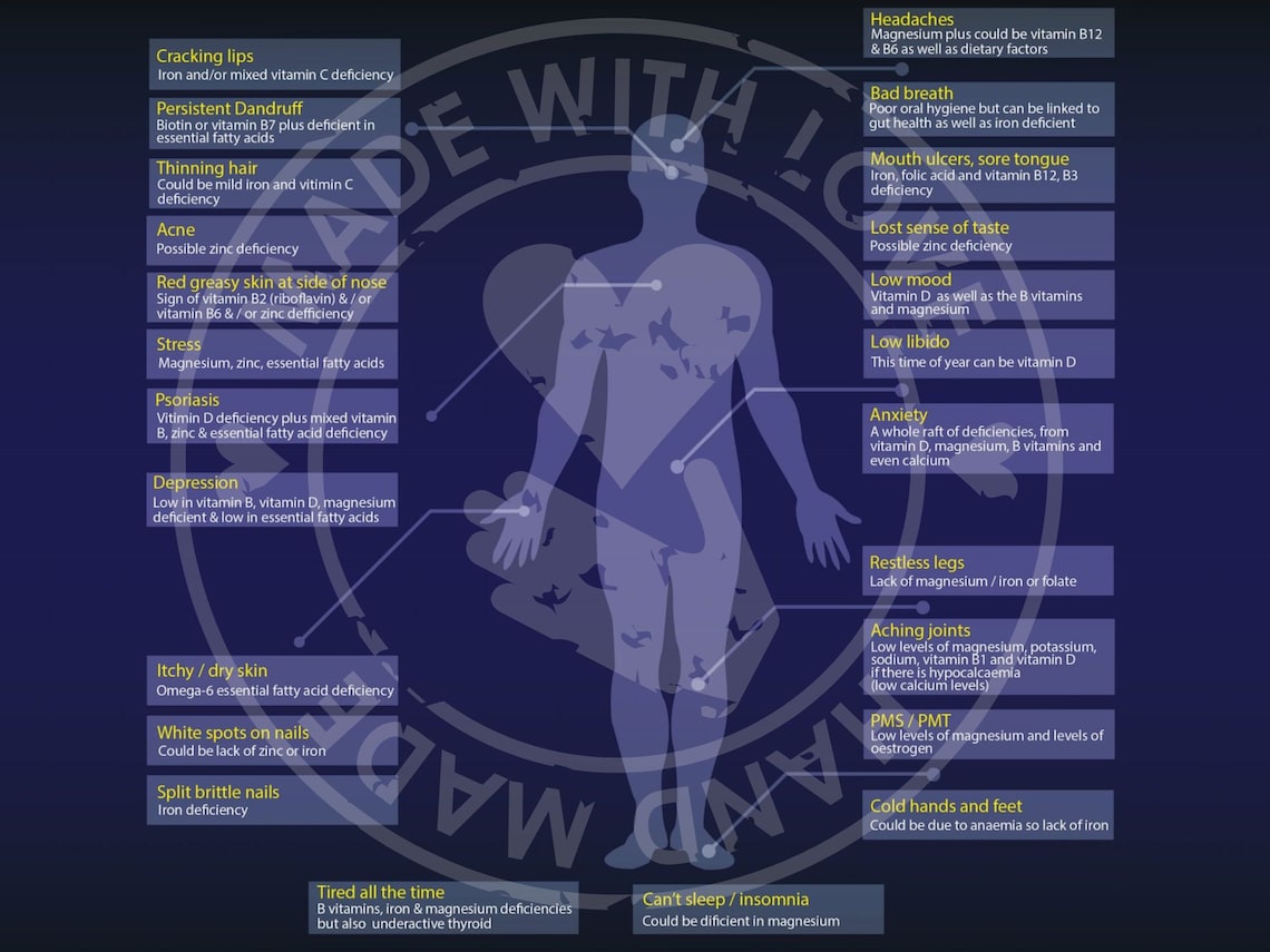 Mineral Deficiency Body Diagram Poster: Healthcare Wellness Print (PDF ...