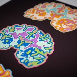 Brain Scan Original Illustration Print - Etsy