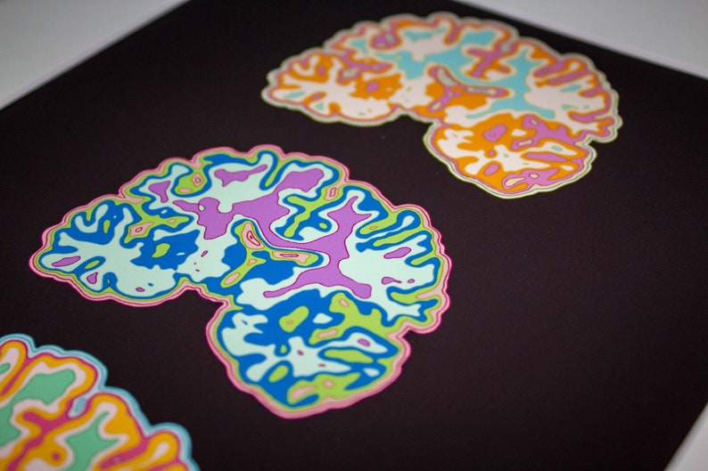 Brain Scan Original Illustration Print | Etsy