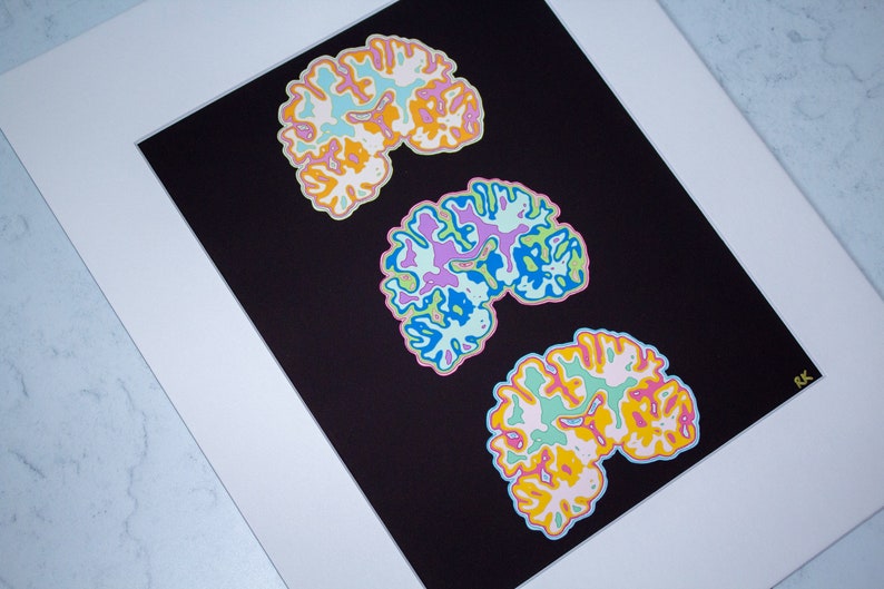 Brain Scan Original Illustration Print | Etsy