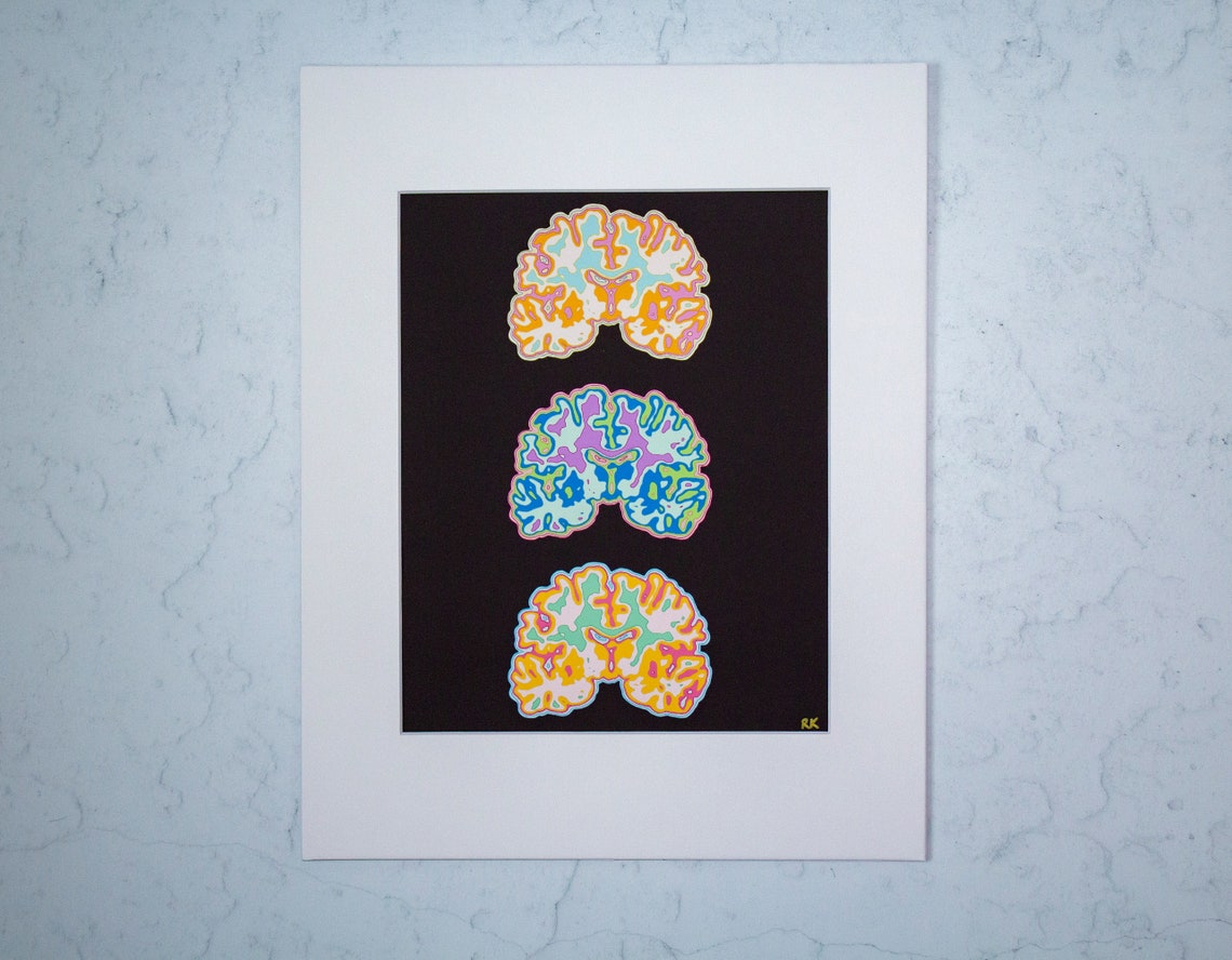 Brain Scan Original Illustration Print | Etsy