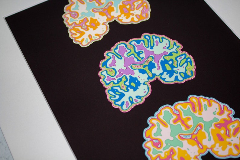 Brain Scan Original Illustration Print | Etsy