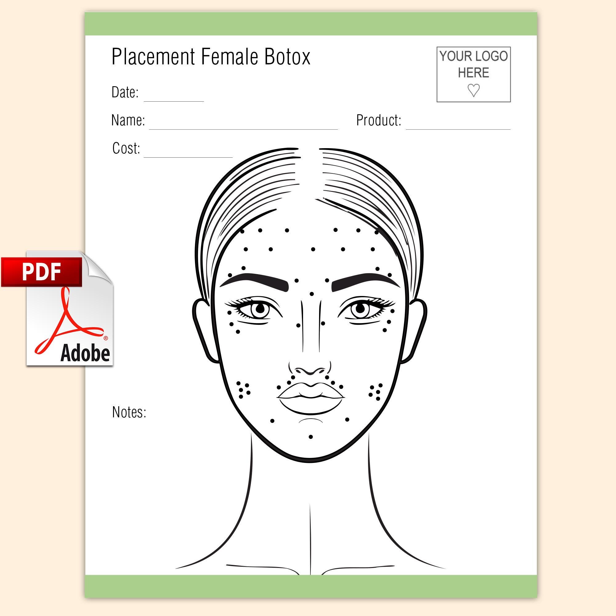 Placement Female Botox Template PDF Document, Small Business Fillable ...