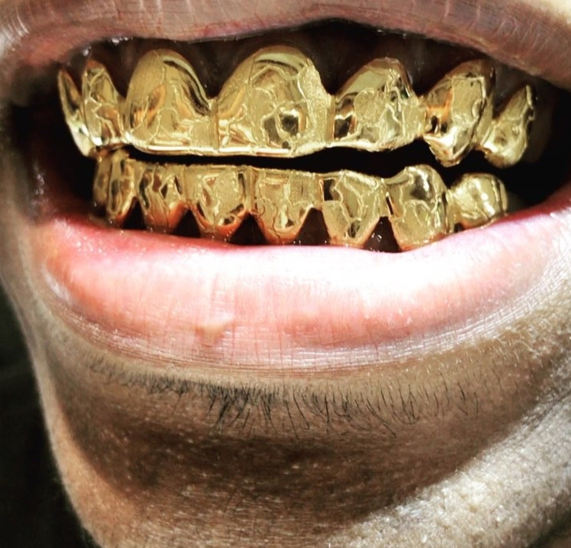 Solid 10 Karat Yellow Gold W/ Nugget Cut Custom Fit Handmade Real Grill ...