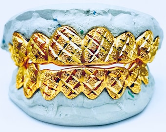 Npg Gold Grill - Etsy